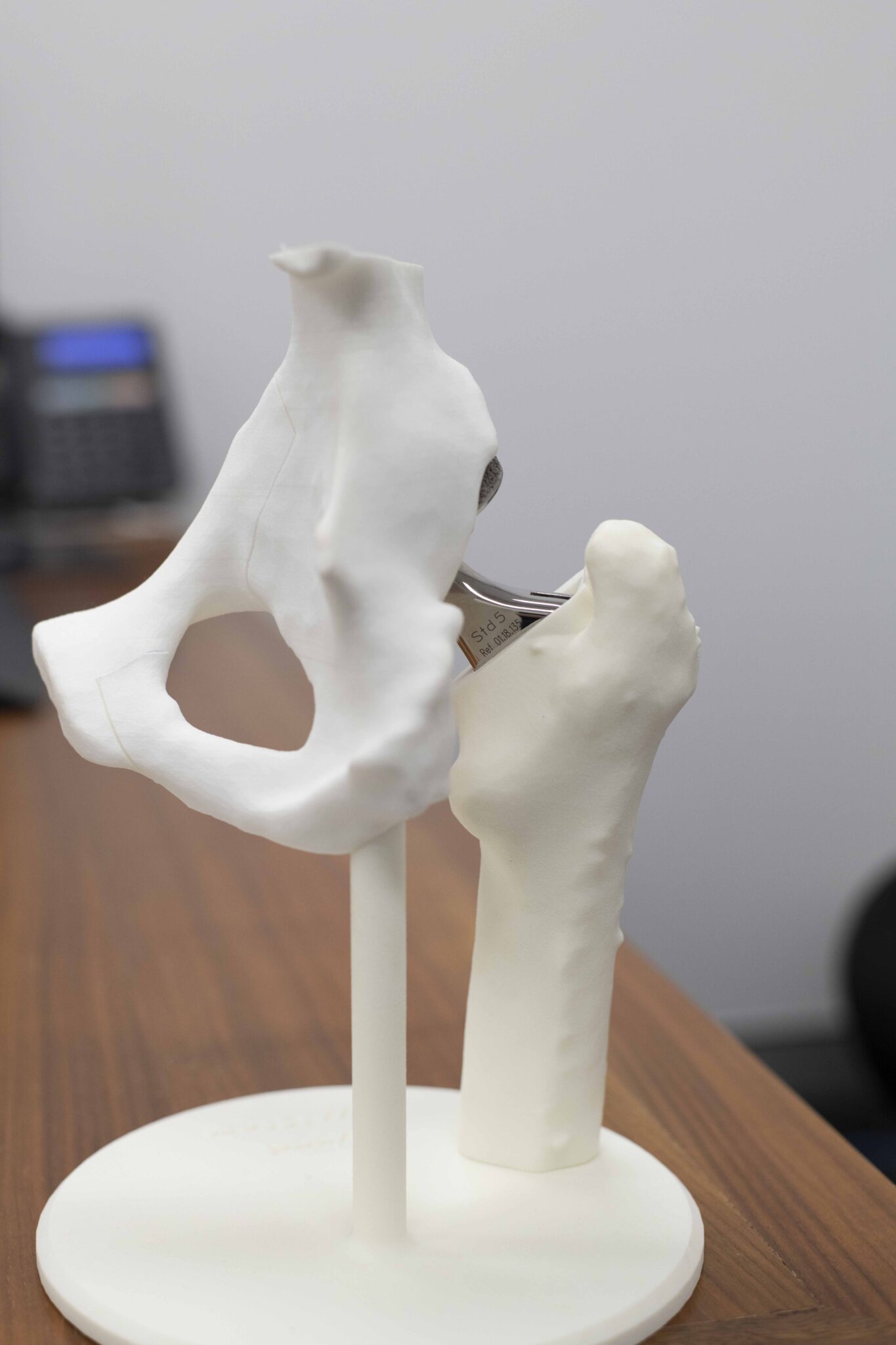 How Much Does Total Hip Replacement Surgery Cost In Australia? - Sam Martin